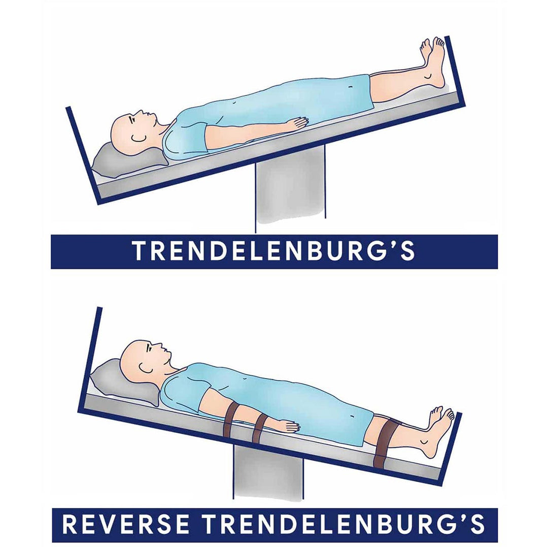 Funzione Trendelenburg / anti Trendelenburg – Kinemed srl | Articoli ...